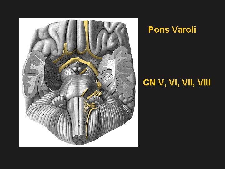 Brainstem Mesencephalon Pons Medulla oblongata nuclei of CN