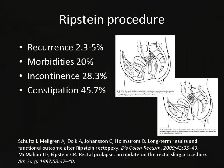 Abdominal approach for Rectal prolapse Leung Yu Wing