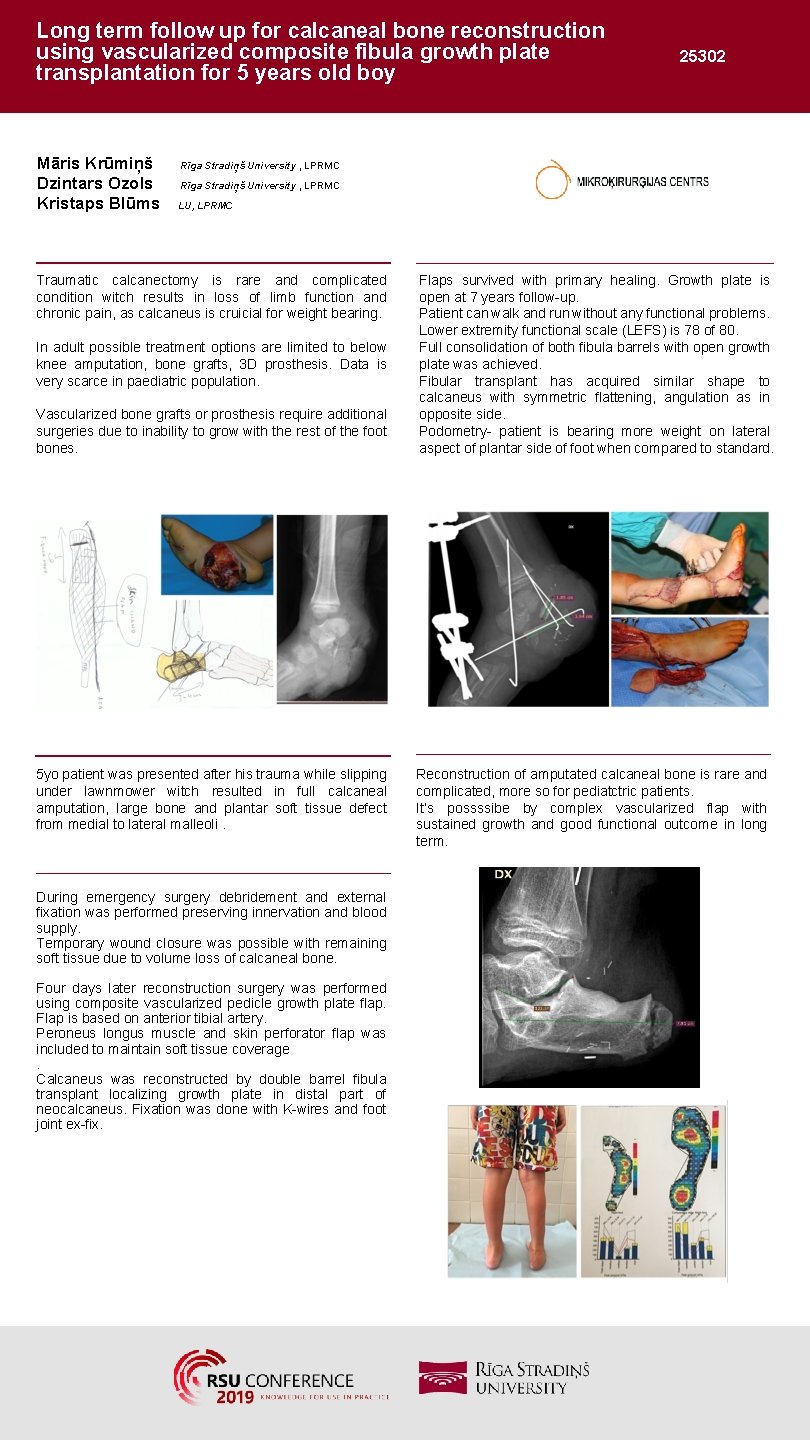 Long term follow up for calcaneal bone reconstruction