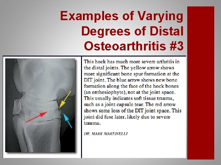 Distal Tarsal Joint Synovitis Osteoarthritis EQS 200 The