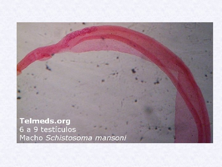 Remember Autoinfection Mode of infection Infective stage Definitive