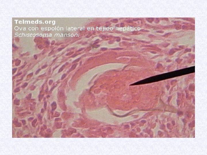 Remember Autoinfection Mode of infection Infective stage Definitive