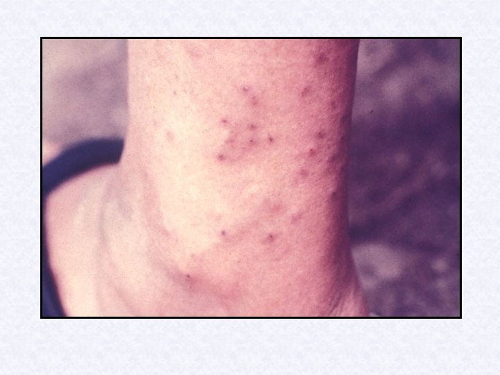 Remember Autoinfection Mode of infection Infective stage Definitive