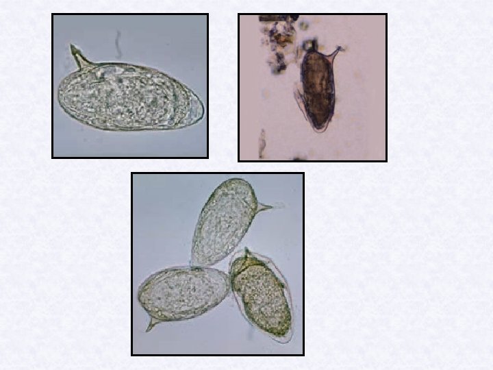 Remember Autoinfection Mode of infection Infective stage Definitive