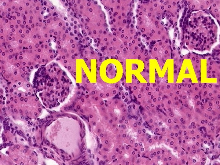 Pathology of Kidney Dr Sachin Kale MD Associate