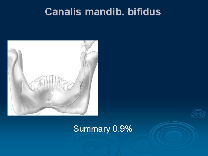 MANDIBULA Lower jaw Anatomy repetition Widespread description and