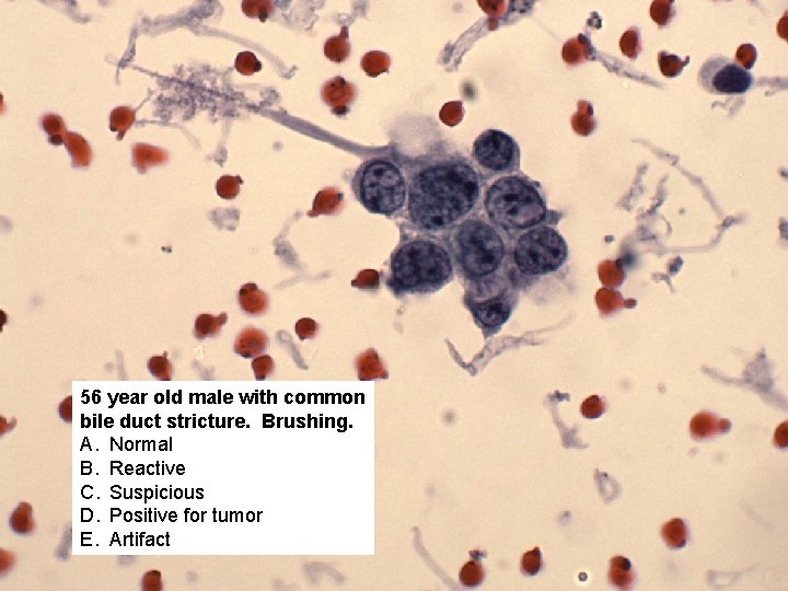 Cytopathology Challenge Weekly Cases October 15 th 2007