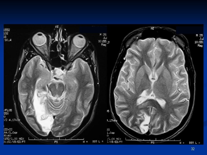 Radiology of common brain diseases 366 RAD 1