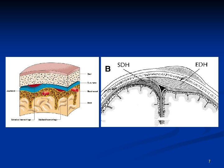 Radiology of common brain diseases 366 RAD 1