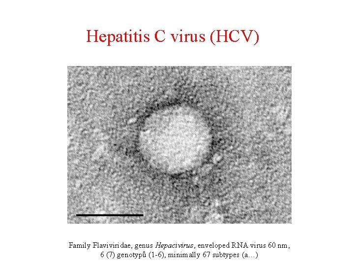 Viral Hepatitis prof MUDr Petr Husa CSc Klinika
