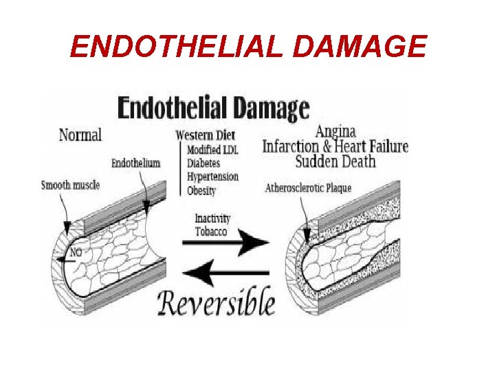 THROMBOSIS DEFINITION PROCESS OF FORMATION OF SOLID MASS