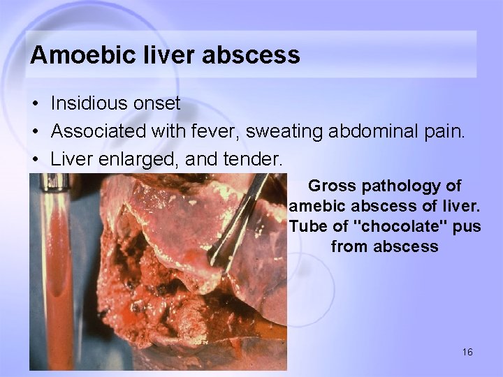 AMOEBAE 1 Entamoeba histolytica Morphologic forms 1 Active