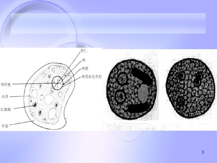 AMOEBAE 1 Entamoeba histolytica Morphologic forms 1 Active