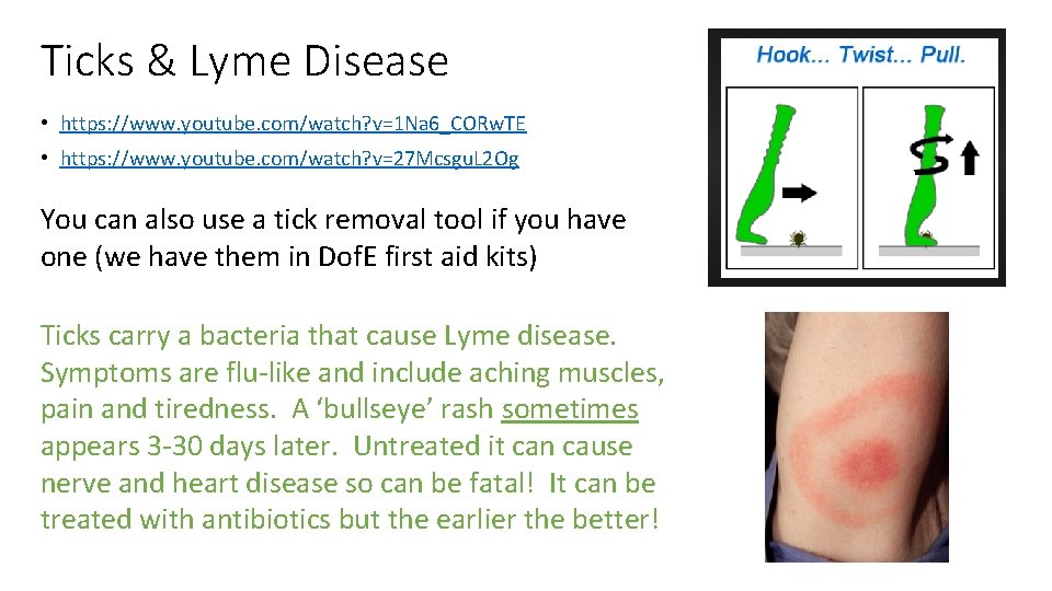 10 Stings bites ticks Weils disease s e