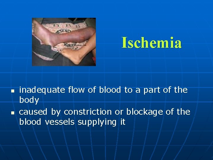Cardiovascular Problems Chapter 11 External Heart Anatomy Left