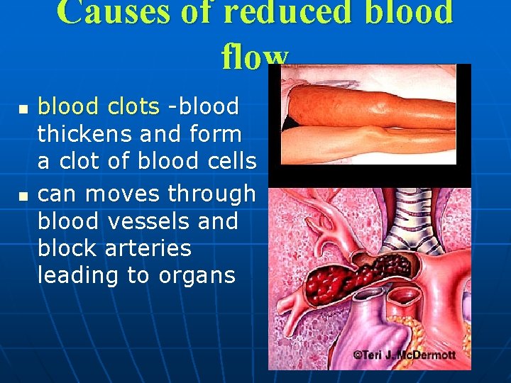 Cardiovascular Problems Chapter 11 External Heart Anatomy Left