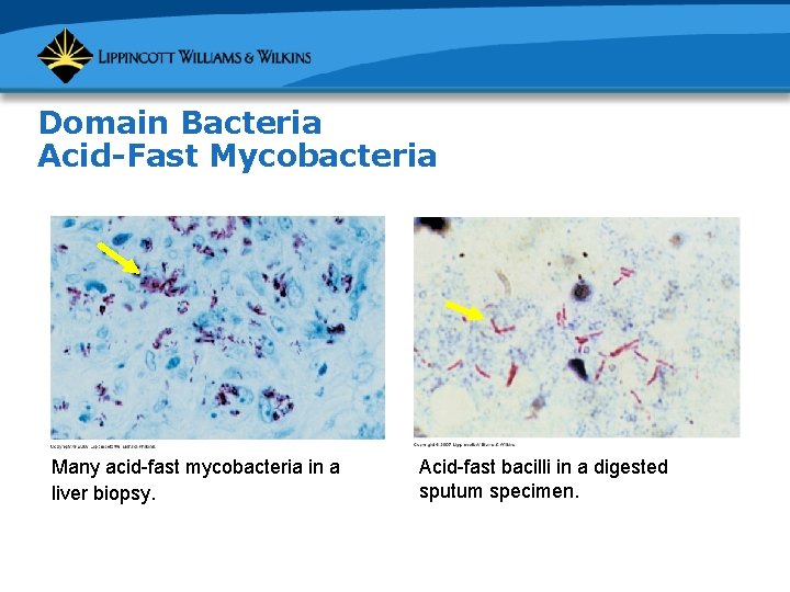 Microbiology Microorganisms Continued Class 2 Domain Bacteria Staining