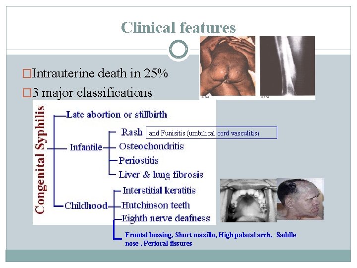 Transplacental Congenital Infection ALI M SOMILY MD Objectives