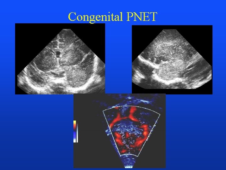 Current Radiology diagnostic radiology interventional radiology ...