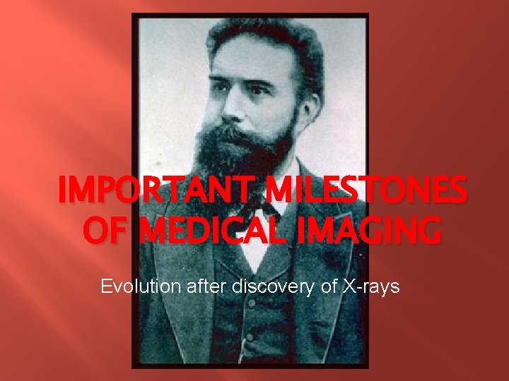 IMPORTANT MILESTONES OF MEDICAL IMAGING Evolution after discovery
