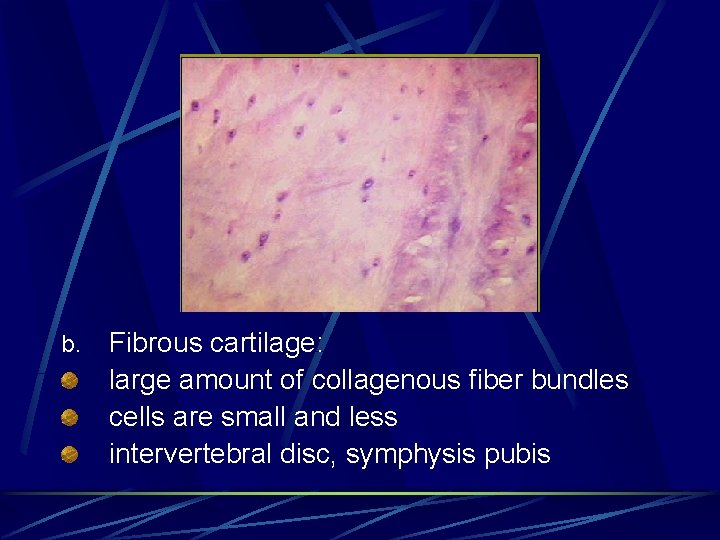 Cartilage and Bone 1 Cartilage organCartilage tissueperichondrium 1