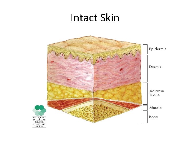 WOUND CARE MANAGEMENT A Crash Course Alvyn Joy