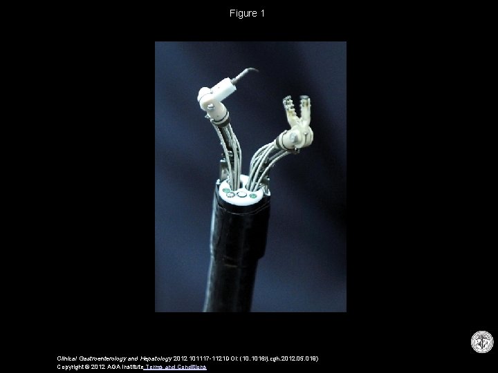 RobotAssisted Endoscopic Submucosal Dissection Is Effective in Treating
