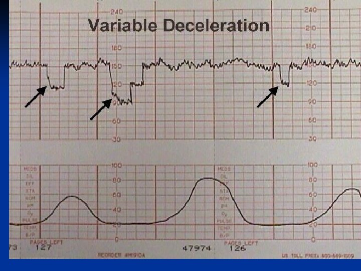 Assessment of fetal wellbeing in labour Dr DINA