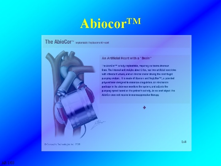 Advanced Angioplasty 2003 NonCoronary Intervention Circulatory Support ...