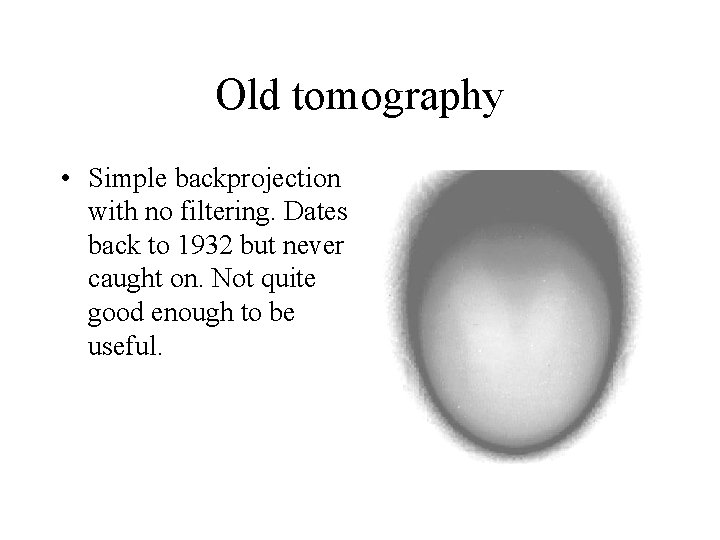Tomography The Radon transform is the key technology