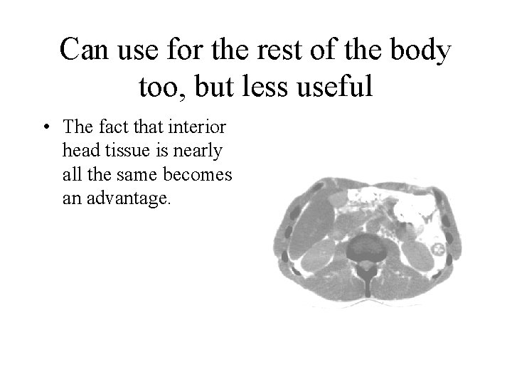 Tomography The Radon transform is the key technology