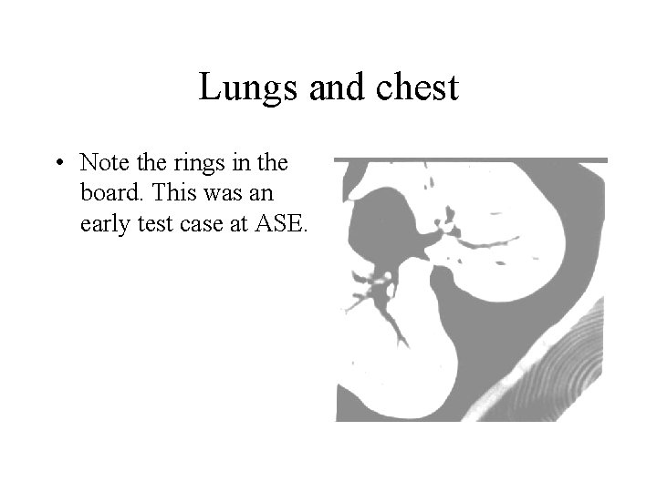 Tomography The Radon transform is the key technology