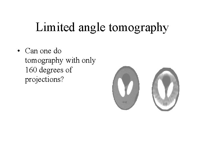 Tomography The Radon transform is the key technology