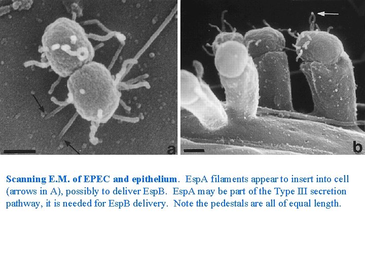 Bacteria and the cytoskeleton The human body is