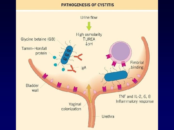 Urinary Tract Infections Symptomatic and asymptomatic UTIs are