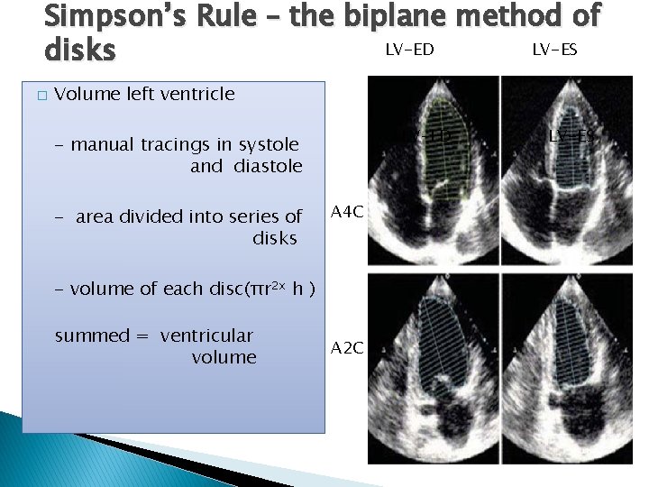 EVALUATION OF SYSTOLIC FUNCTION ECHOCARDIOGRAPHYANGIOGRAPHY DEEPAK ...