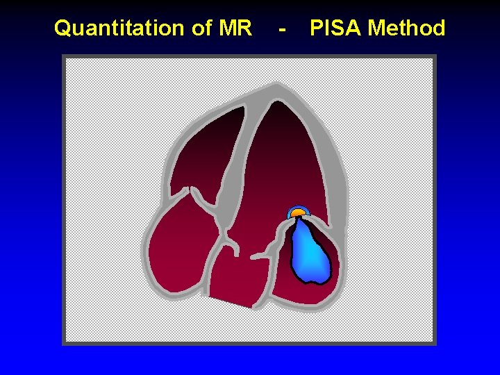 What Is the Echo Gold Standard to Measure