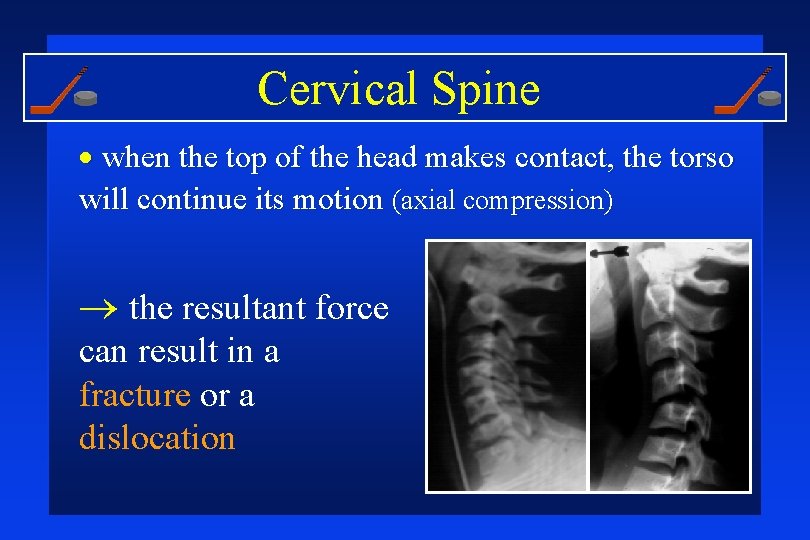 Cervical Spine when the top of the head