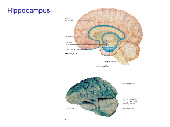 Hippocampus and Memory I Case of H M