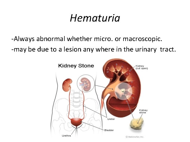 Basics of Urology Dr Ankur Mittal Associate Professor