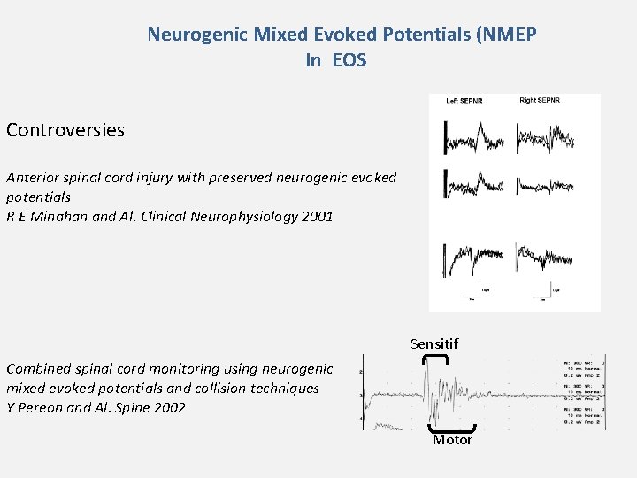 Neurological Complications in EOS and Neuromonitoring Issues G