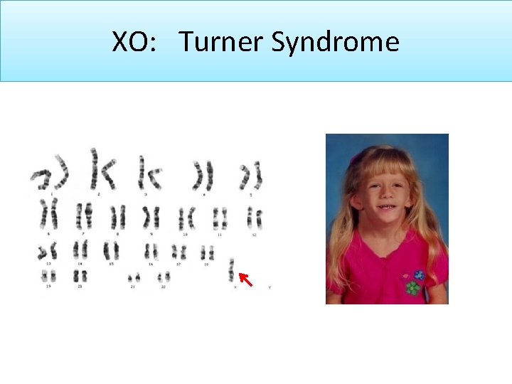 3 C 1 Effect on Phenotype Watch the