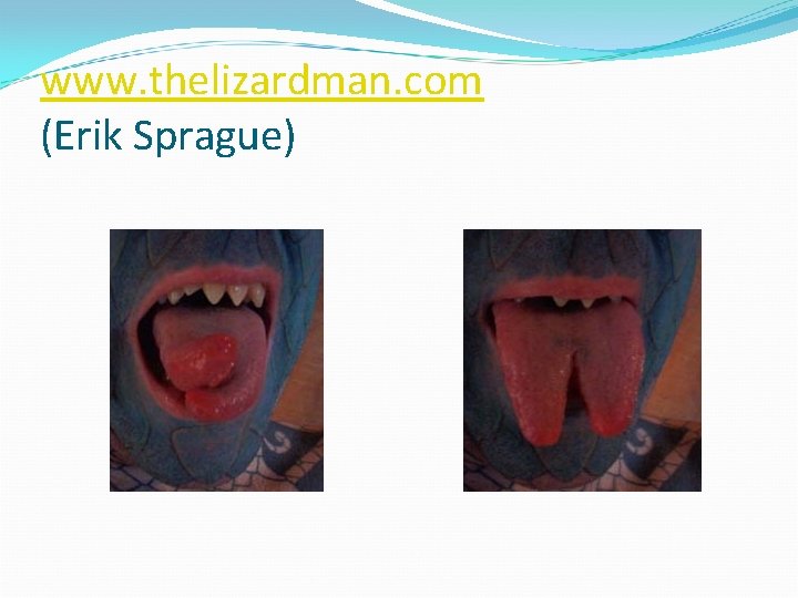 Body Modification Frances Sand Stalking Cat Dennis Avner