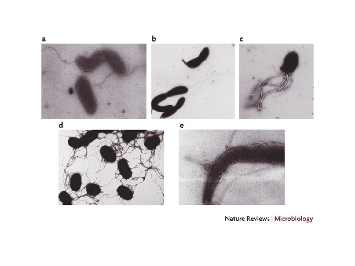 Silver stain for flagella Bactria Escherichia coli Pseudomonas