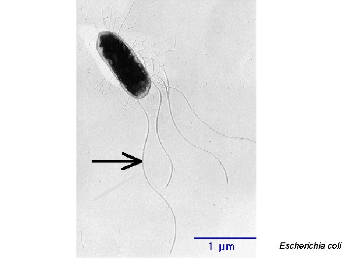 Silver stain for flagella Bactria Escherichia coli Pseudomonas