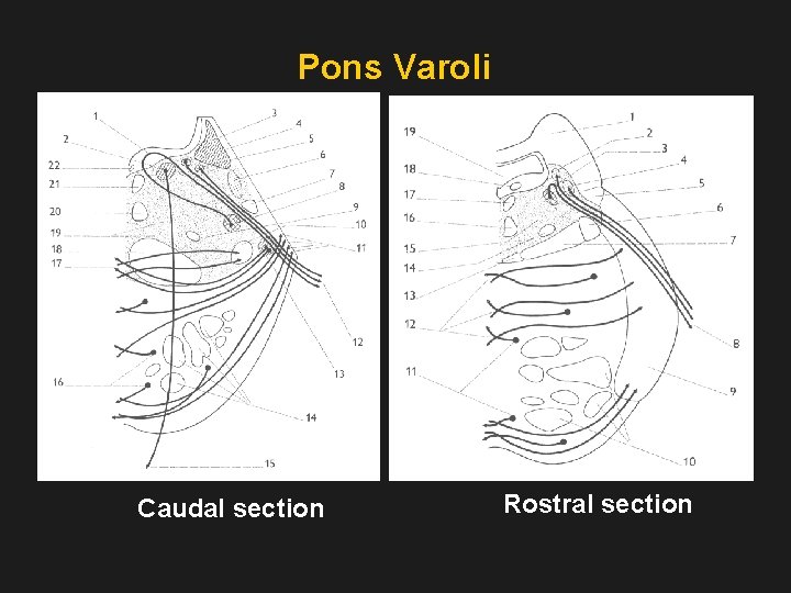 Brainstem Mesencephalon Pons Medulla oblongata nuclei of CN