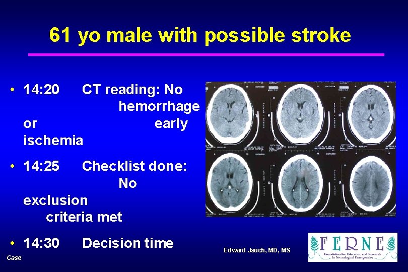 Ischemic Anterior Circulation Stroke Edward C Jauch MD
