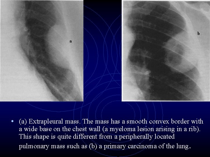 RADIOLOGICAL EXAMINATION OF THE LUNG AND PLEURA DEPARTMENT