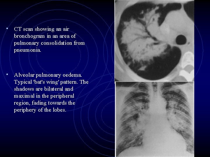 RADIOLOGICAL EXAMINATION OF THE LUNG AND PLEURA DEPARTMENT