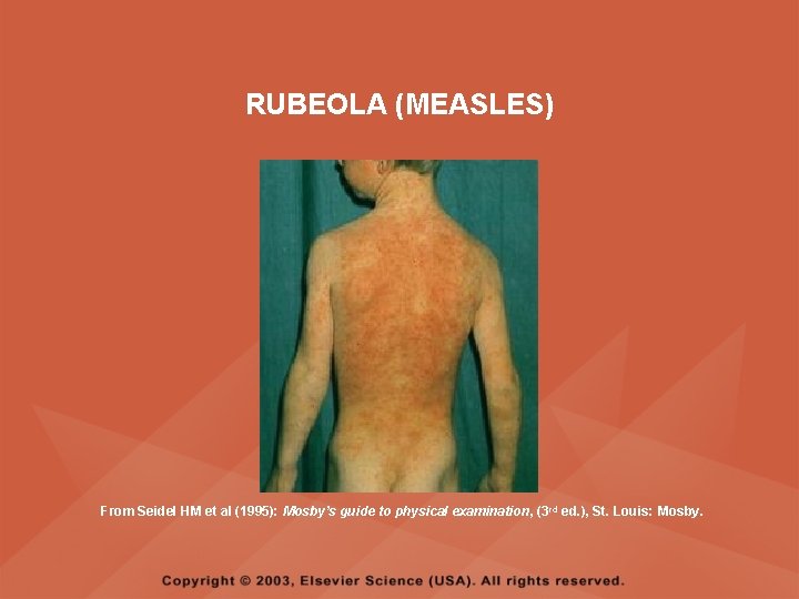 INFECTIOUS AND COMMUNICABLE DISEASES PYRAMID POINTS Clinical manifestations